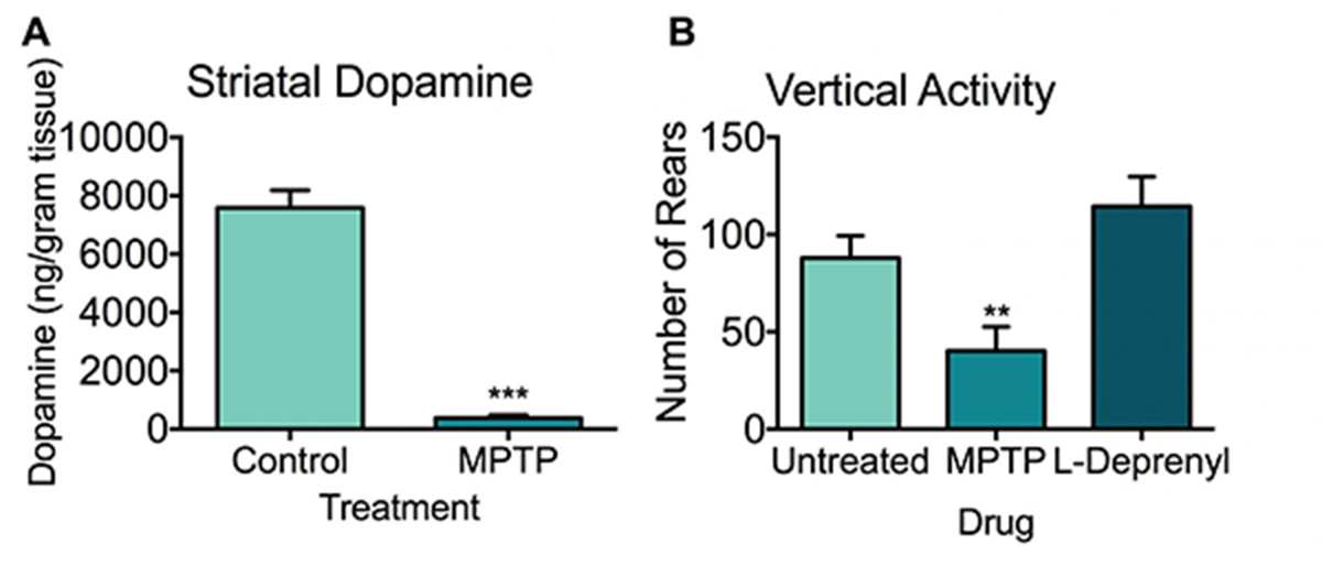Urinary Incontinence, Overactive Bladder Model | Melior